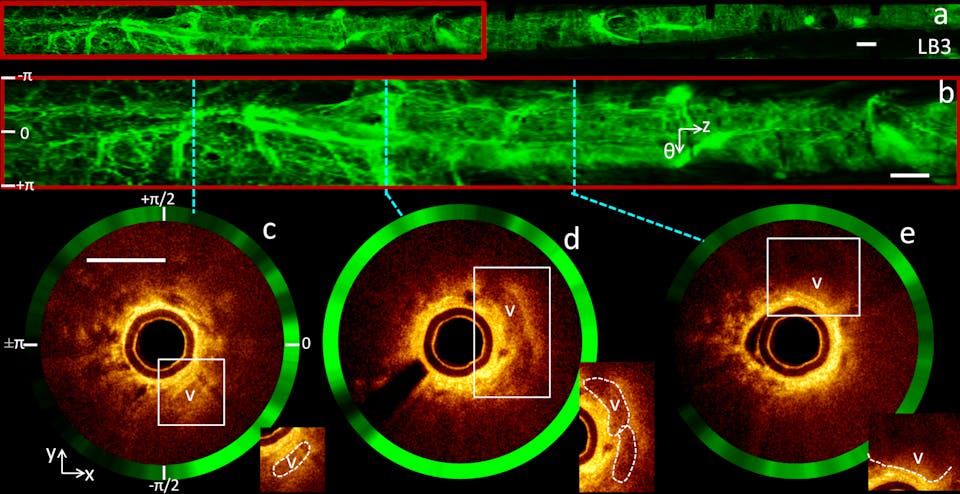 Biomedical Imaging | Castor