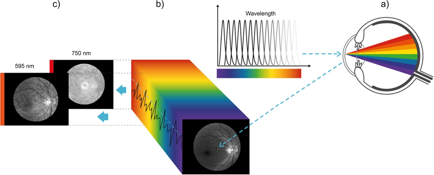 Hyperspectral Retinal Imaging | Photon etc. Hyperspectral Retinal Imaging | Photon etc.